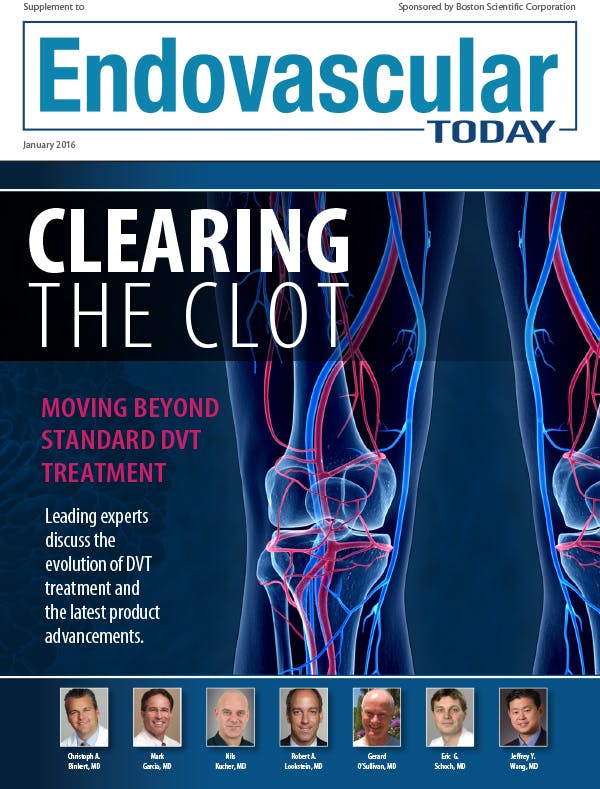 Case Report: The ZelanteDVT™ Thrombectomy Catheter for Venous ...