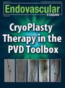 CryoPlasty Therapy for the Infrainguinal Arteries - Endovascular Today