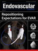 A Practical Look at EVAR Fixation - Endovascular Today