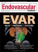 What Is Your Preferred EVAR Device and Why? - Endovascular Today