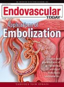 An Overview of Embolics - Endovascular Today