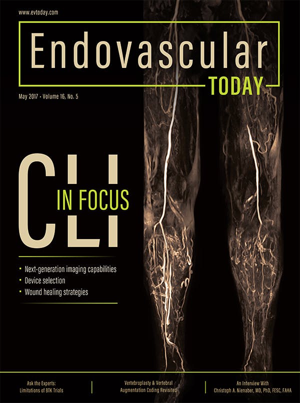 Vertebroplasty and Vertebral Augmentation Coding Revisited ...