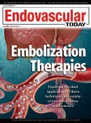 Embozene™ Color-Advanced Microspheres - Endovascular Today