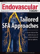 SFA Disease: The Lay of the Land - Endovascular Today