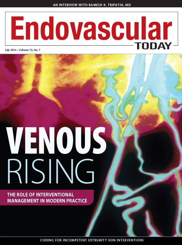 Gonadal Vein Embolization Endovascular Today