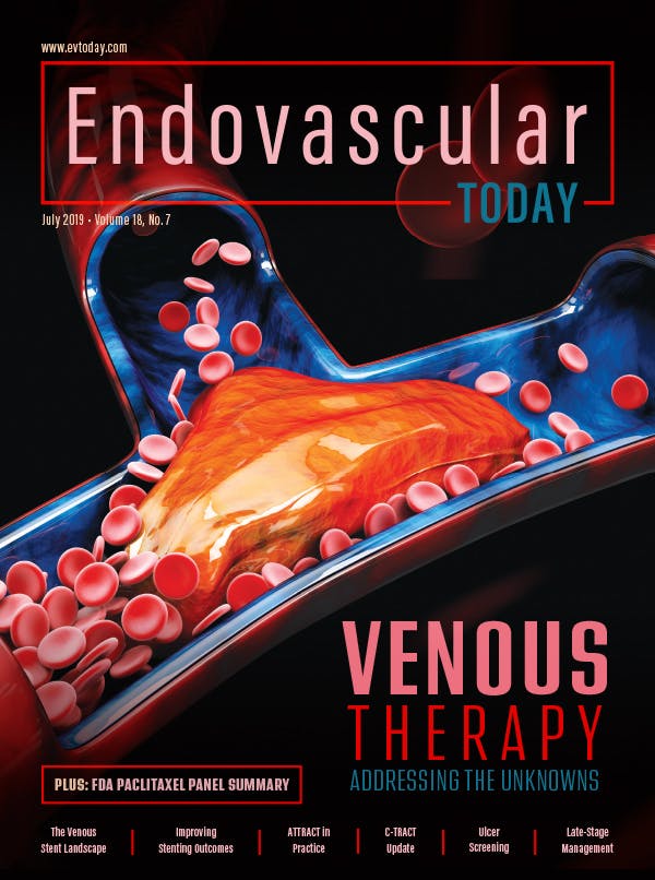 Mechanical Power Aspiration With the Indigo® System: Rethinking Clot ...