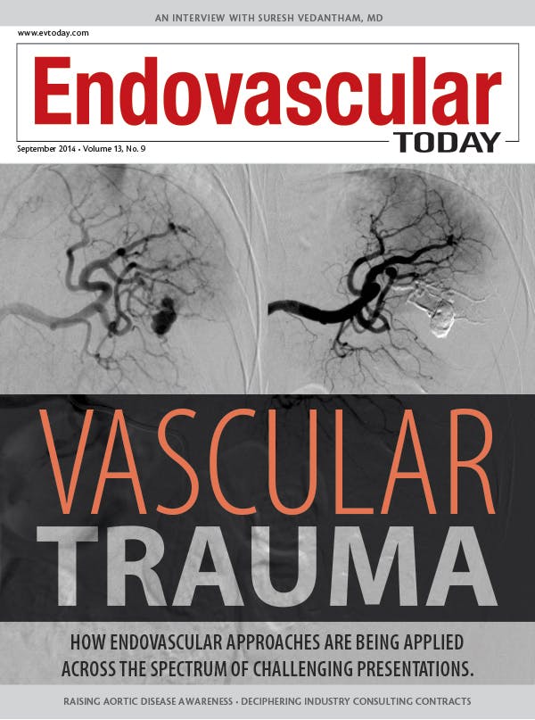 Transcatheter Embolization for Trauma of the Pelvis - Endovascular Today