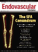 SFA Angioplasty Versus Femoropopliteal Bypass - Endovascular Today