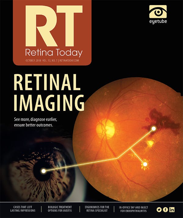 October 2018 Issue - Retina Today